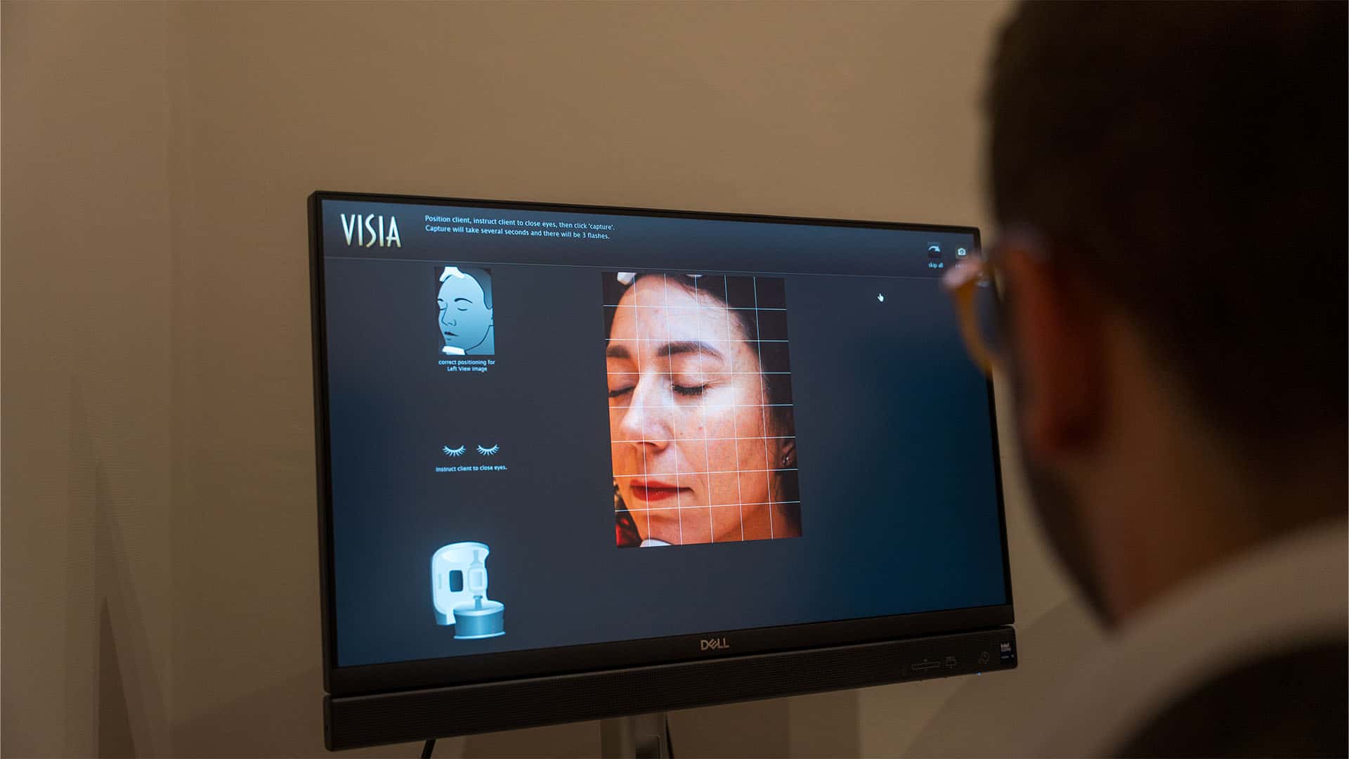 Visia 7 Skin Analysis | Advanced Digital Skin Scanner Consultation